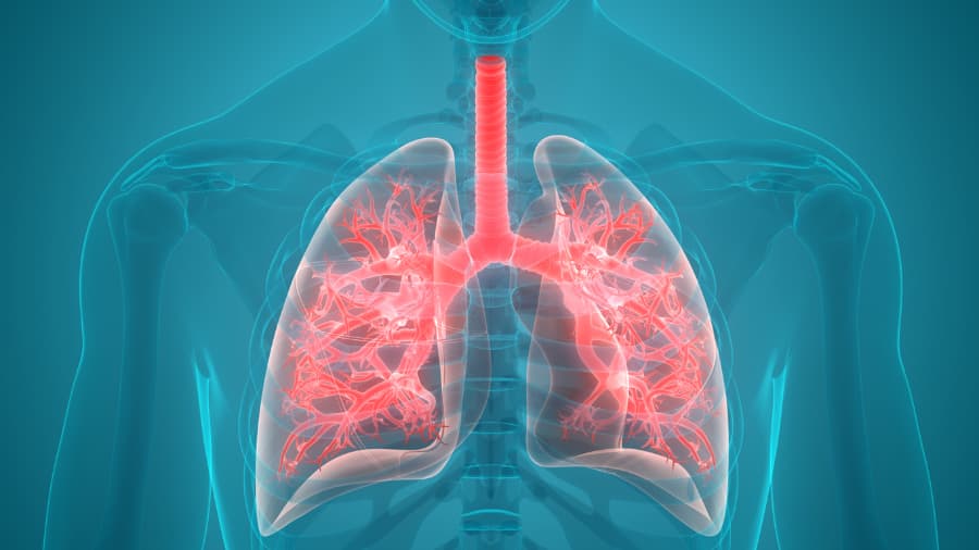 What Is A Respiratory Panel? – TOPLAB®